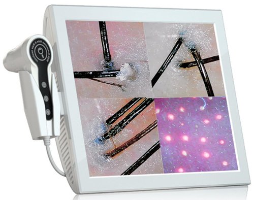 Skin Hair Scalp Detector, Skin Diagnosis Hair Analyzer, Scalp Detector ...